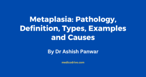 From Squamous to Columnar: Understanding Metaplasia in Clinical and ...
