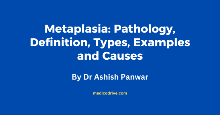 From Squamous to Columnar: Understanding Metaplasia in Clinical and ...