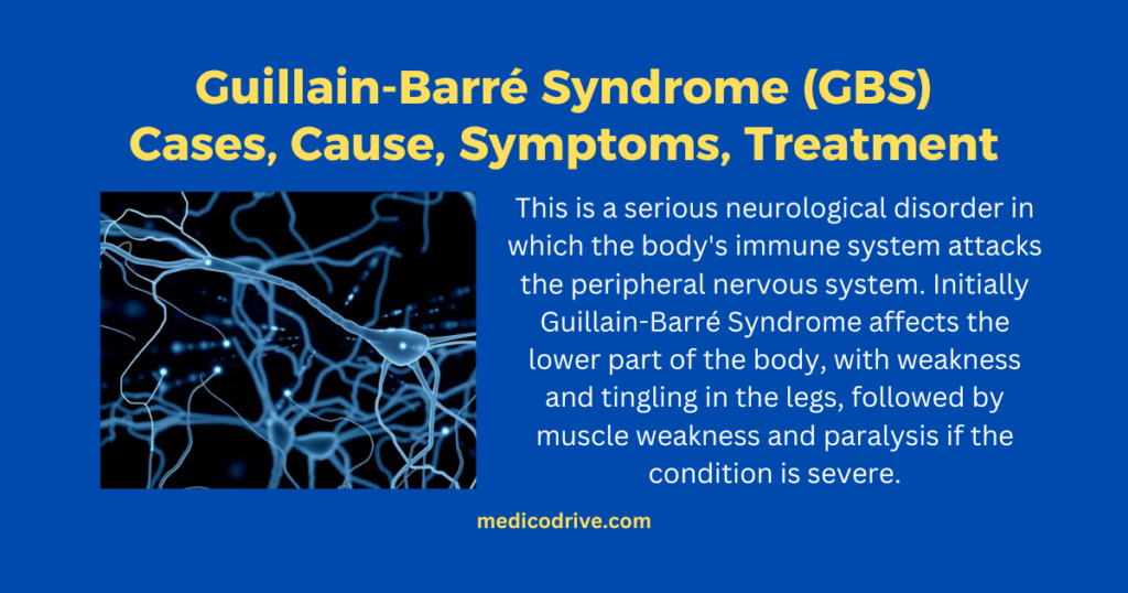 What I Learned Treating GBS Patients: Early Warning Signs, Causes ...